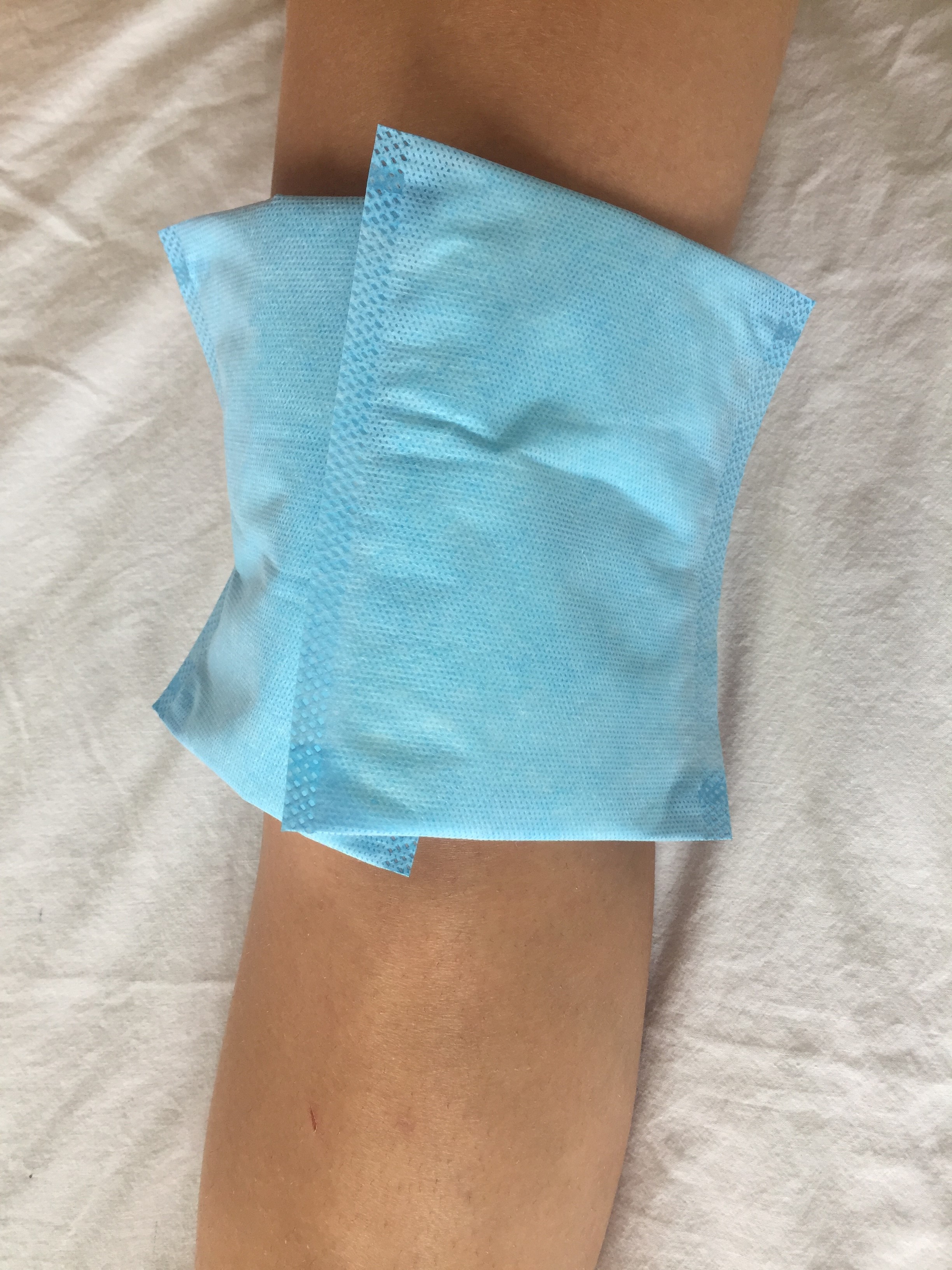 Operation af bagerste korsbånd (PCL) - Aarhus Universitetshospital