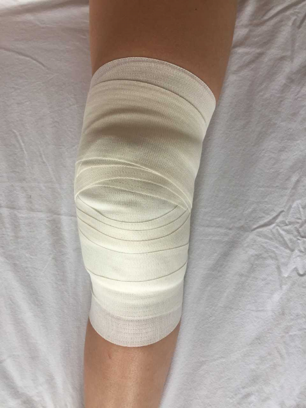 Operation for ledmus (Osteochondritis dissecans) - Aarhus ...